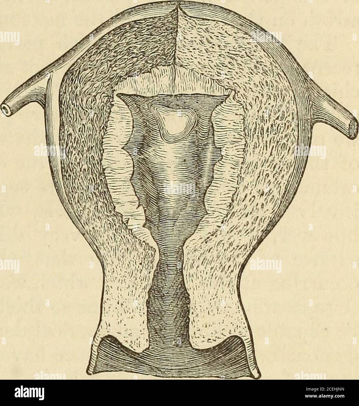 Uterus Lining High Resolution Stock Photography and Images - Alamy