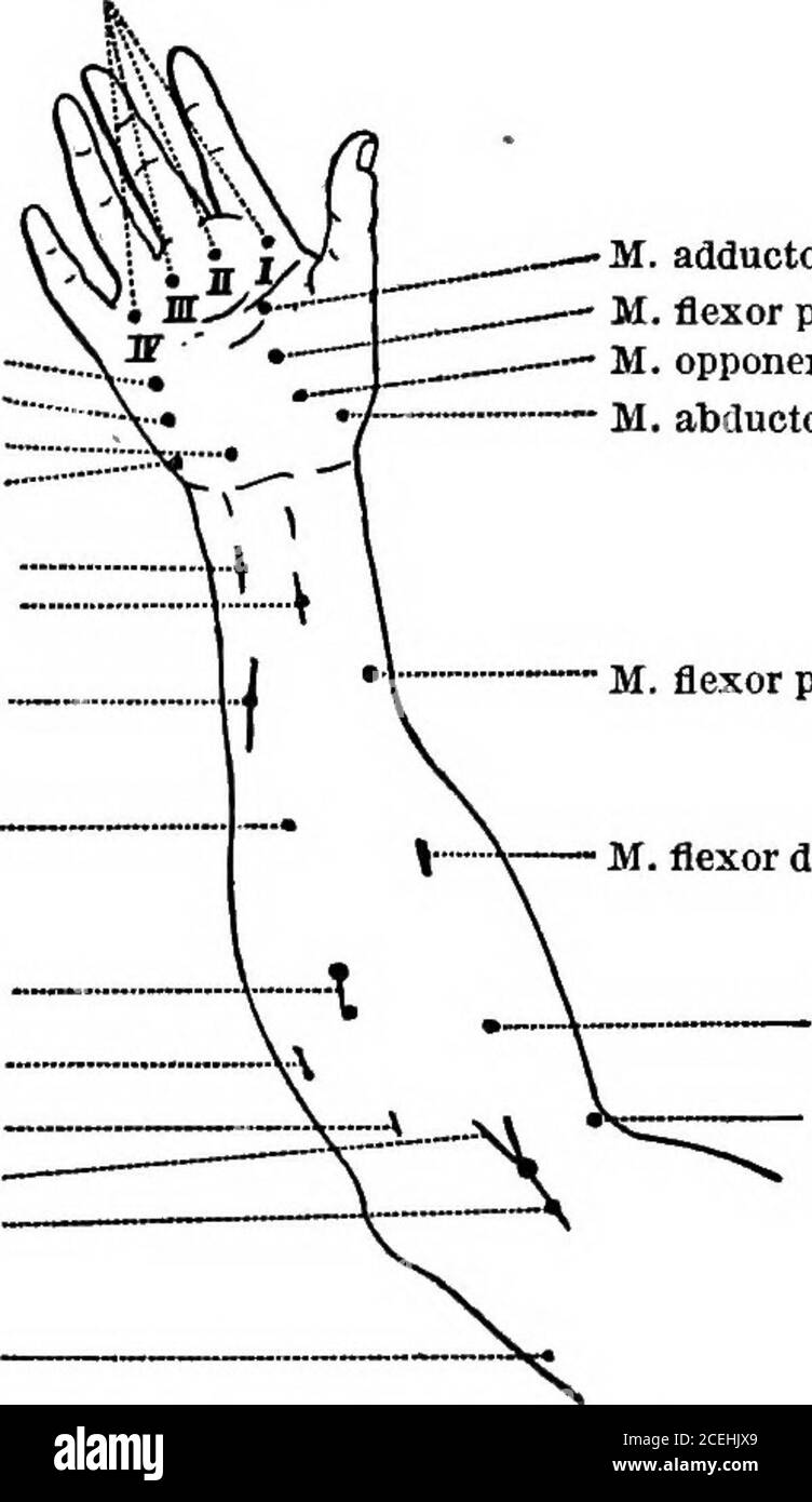 Skin density Black and White Stock Photos & Images - Alamy
