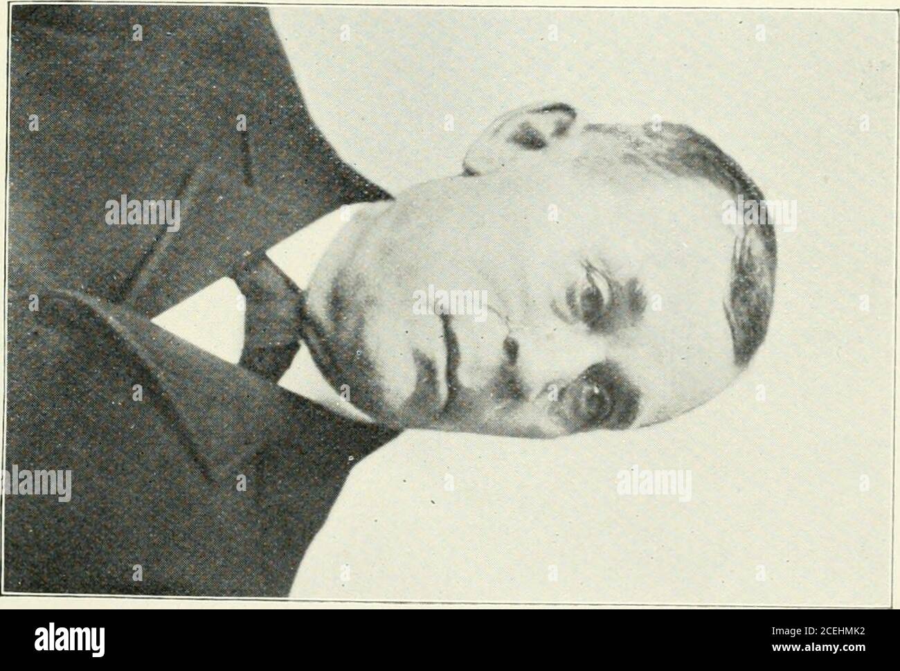 Slight defect hi-res stock photography and images - Alamy