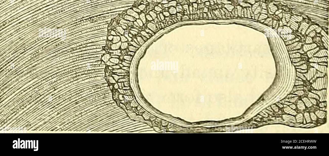 . General surgical pathology and therapeutics, in fifty lectures : a ...