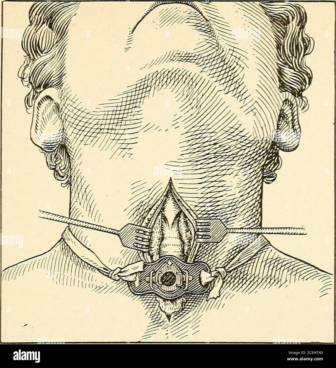 Manual muscle operation hi-res stock photography and images - Alamy