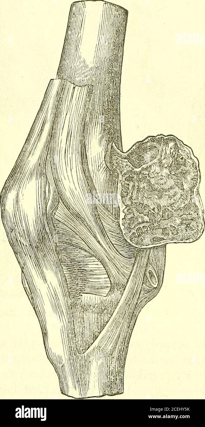 Osteomata hi-res stock photography and images - Alamy