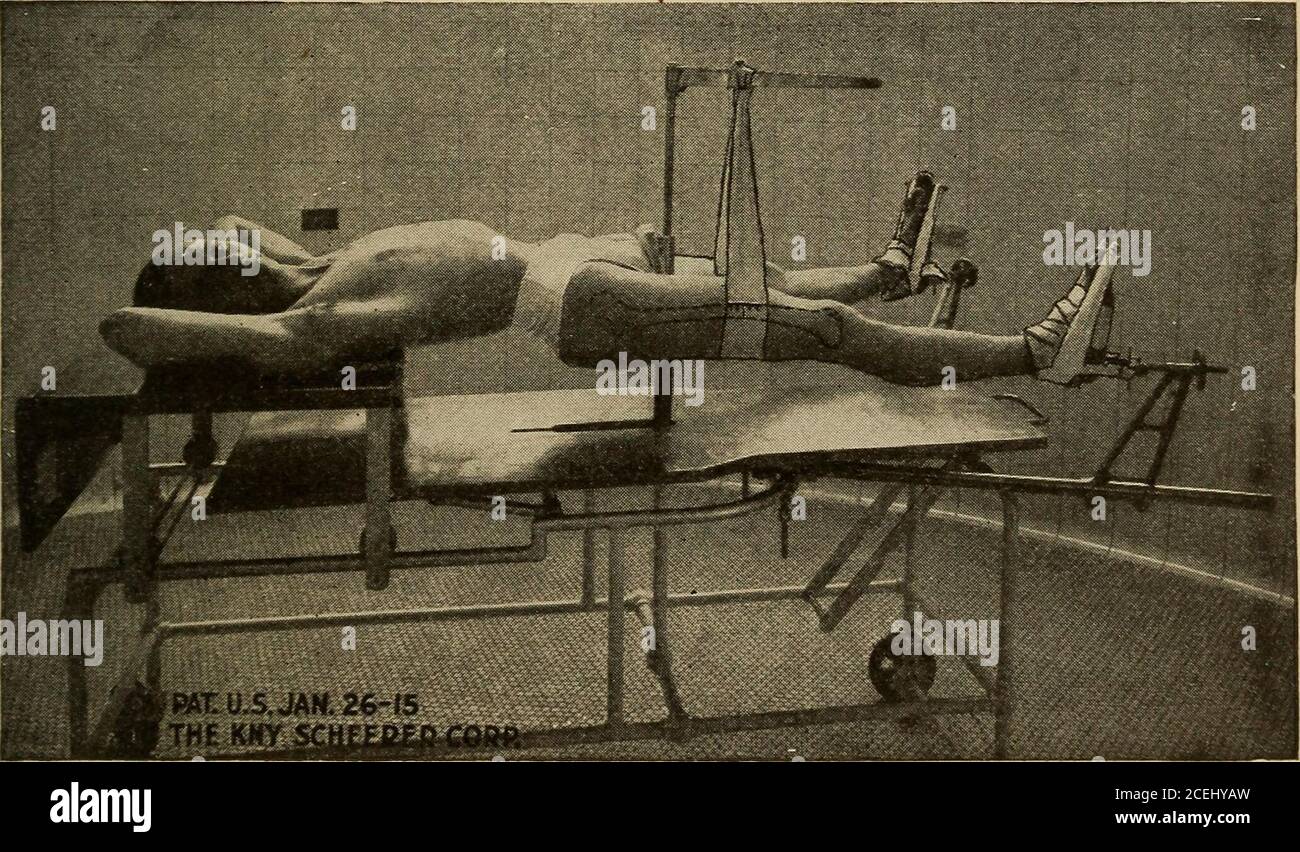 . The operating room, a primer for pupil nurses. Fig. 50.—Fracture and ...