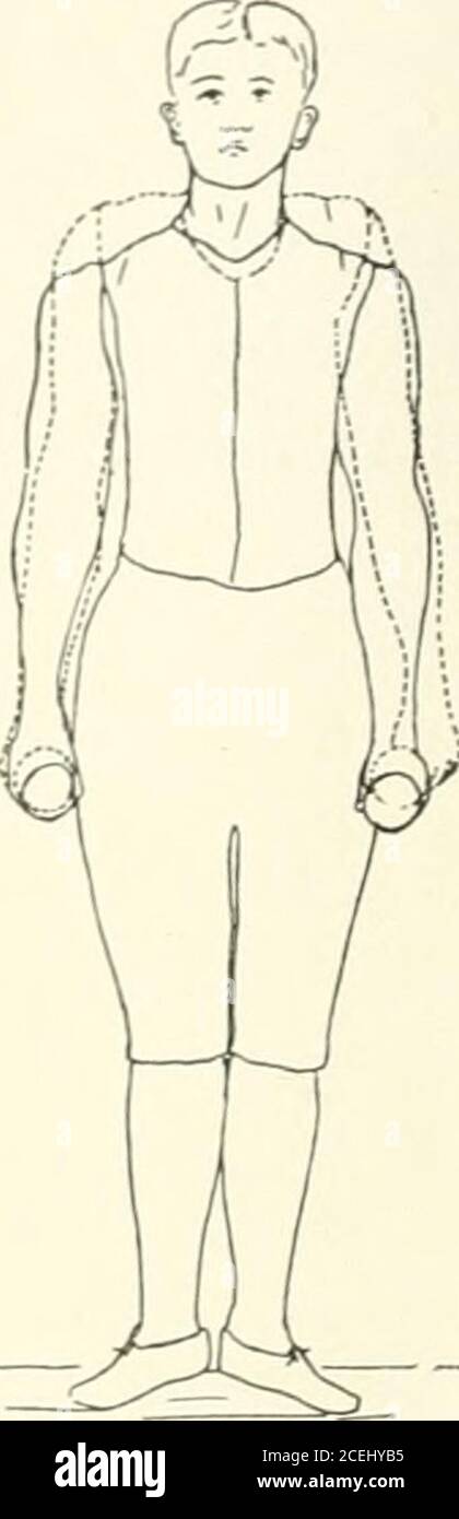 . Annals of surgery. Fig. 13a. Fig. 13b. (12) Exactly the reverse of No ...
