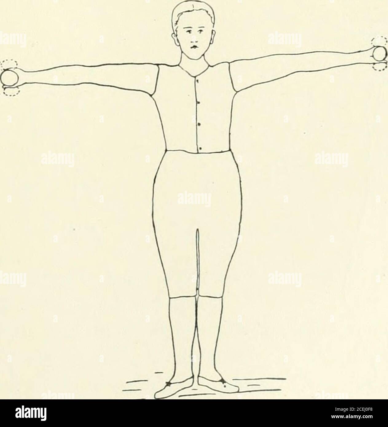 . Annals of surgery. Fig. 6. Fig. 7.. Fig. 8. (9) The arms abducted at ...