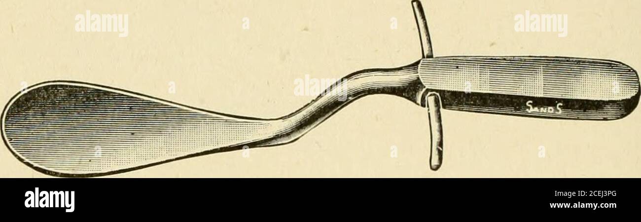Prostatectomy Suprapubic PDF) Robotic Assisted Laparoscopic Simple