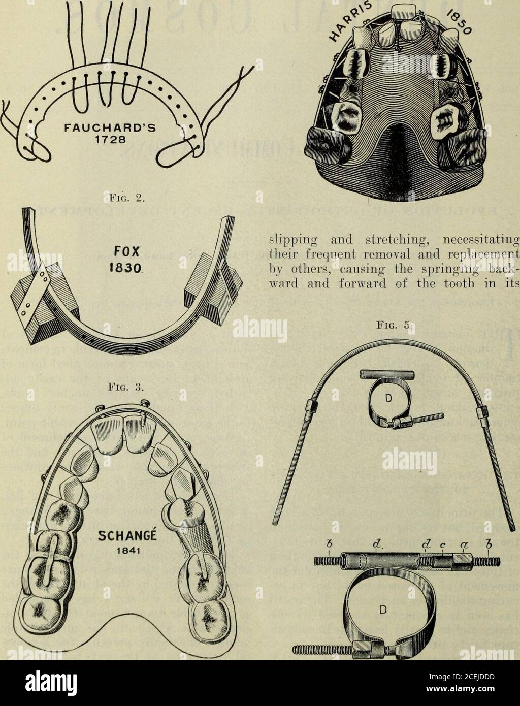 Crude methods hi-res stock photography and images - Alamy