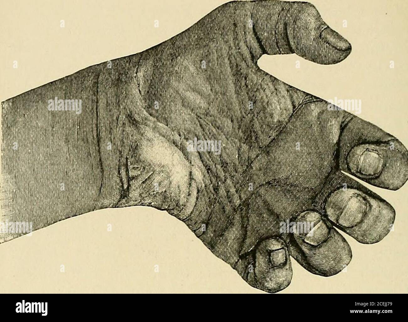 . A treatise on nervous and mental diseases, for students and ...