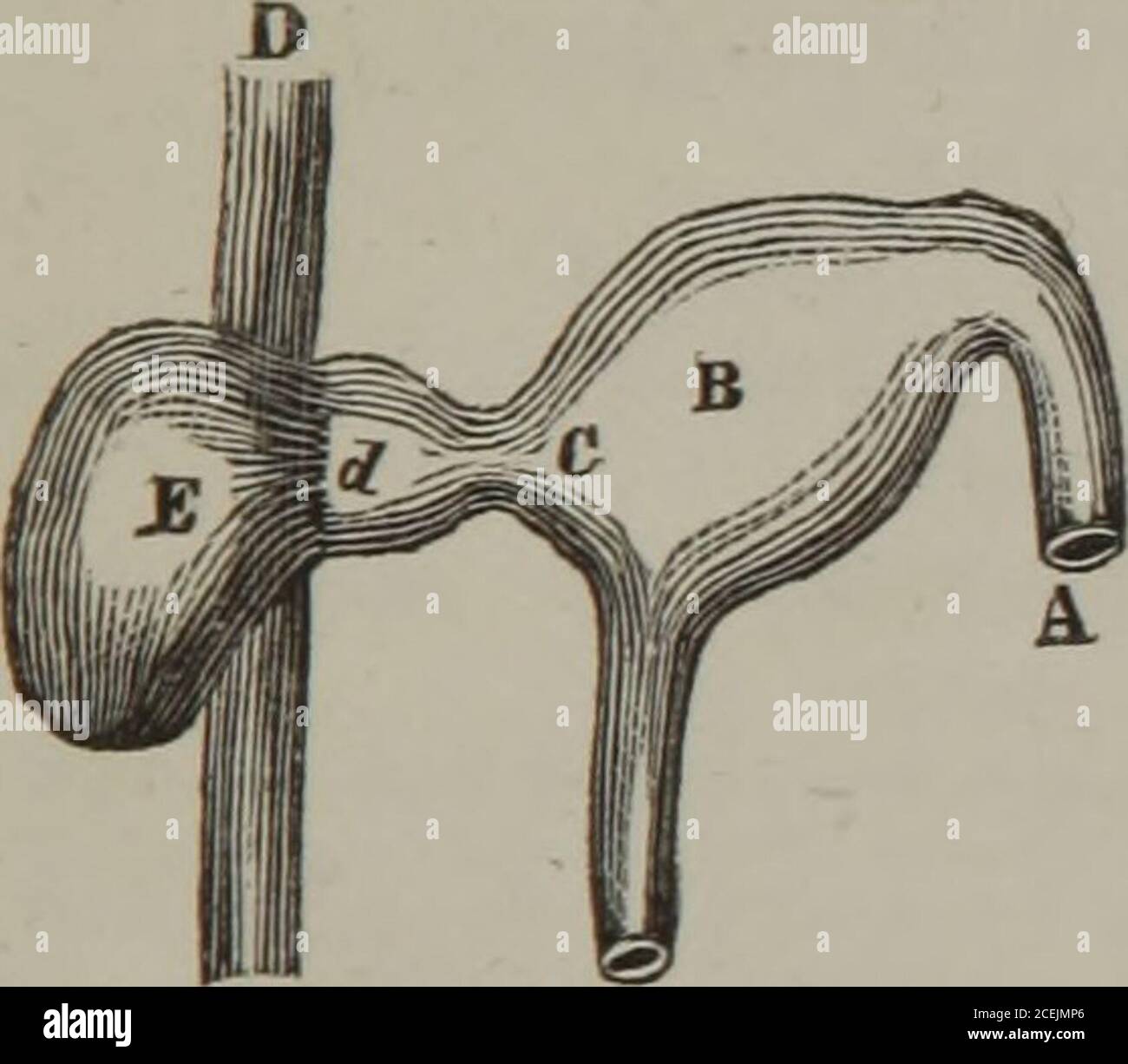 John hunter surgery hi-res stock photography and images - Alamy