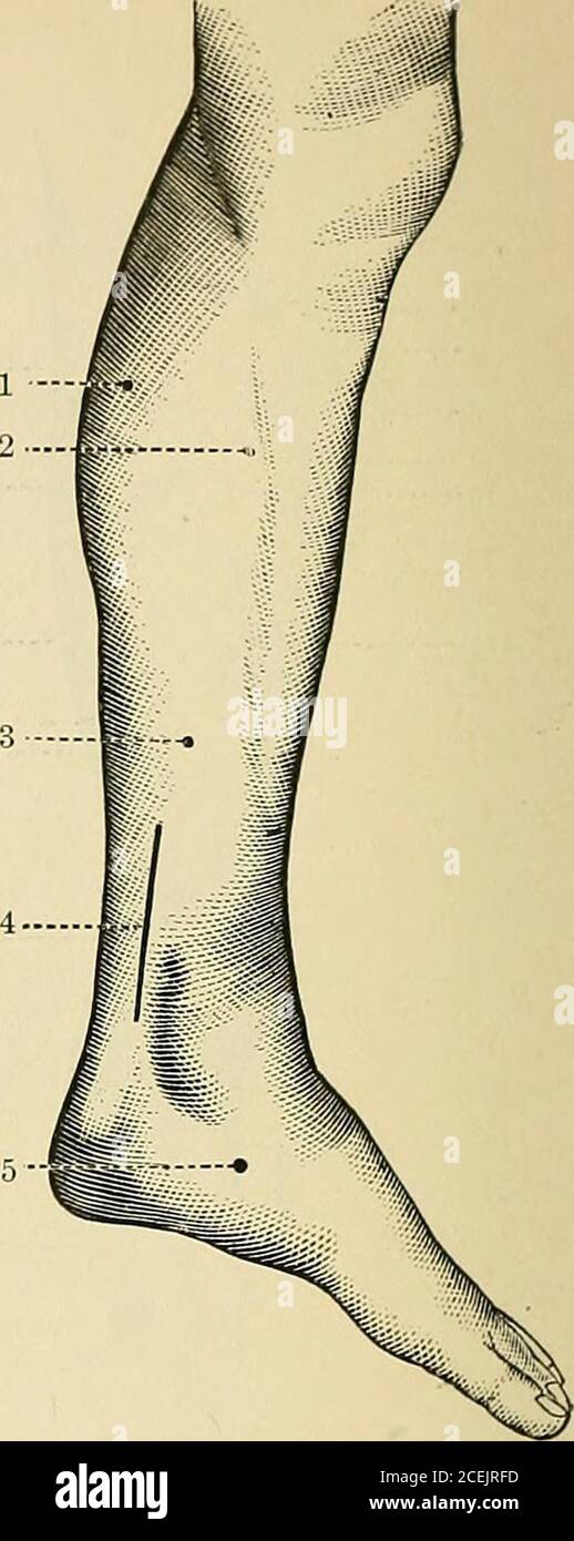 . A treatise on nervous and mental diseases, for students and ...