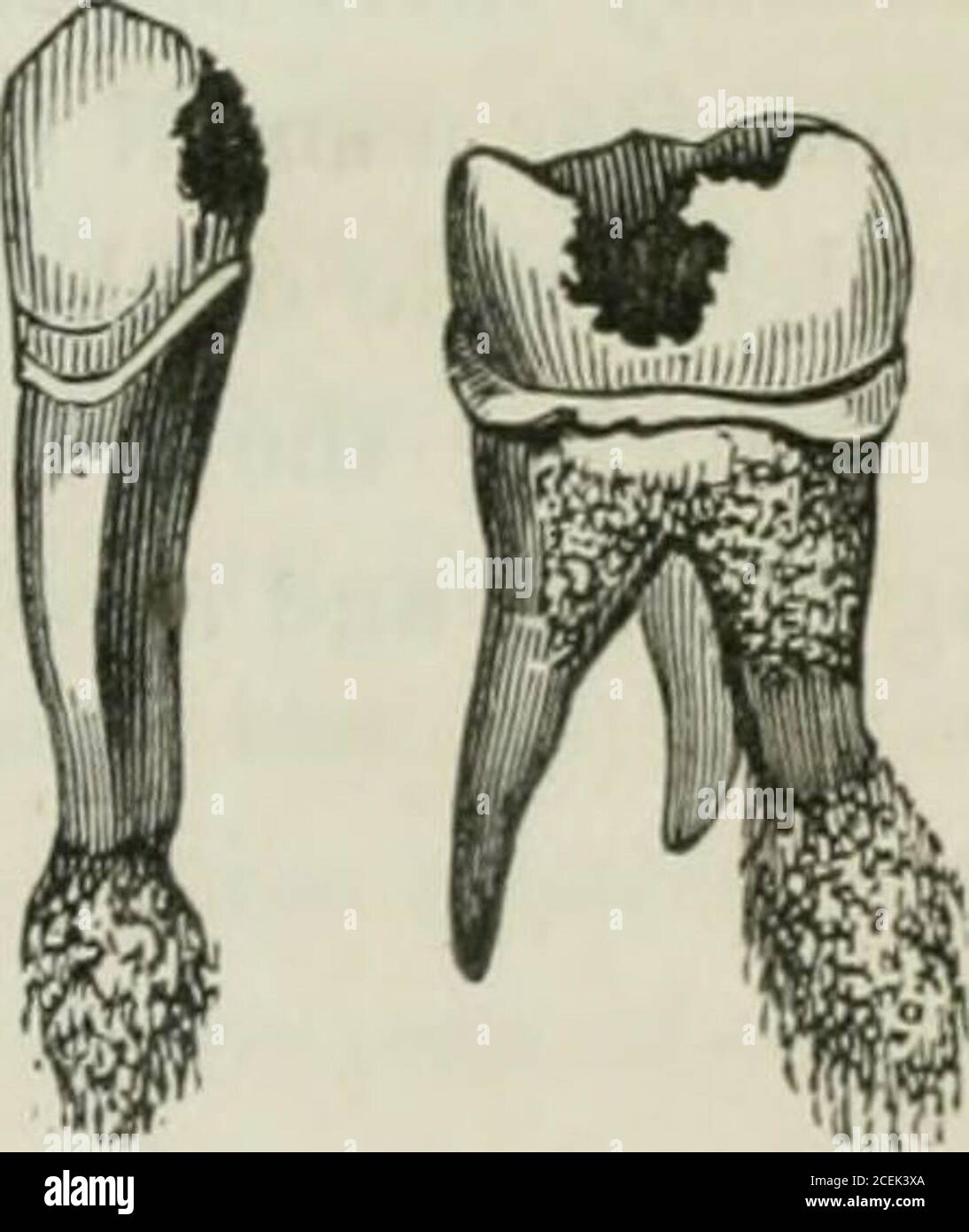Alveolar sac hi-res stock photography and images - Alamy