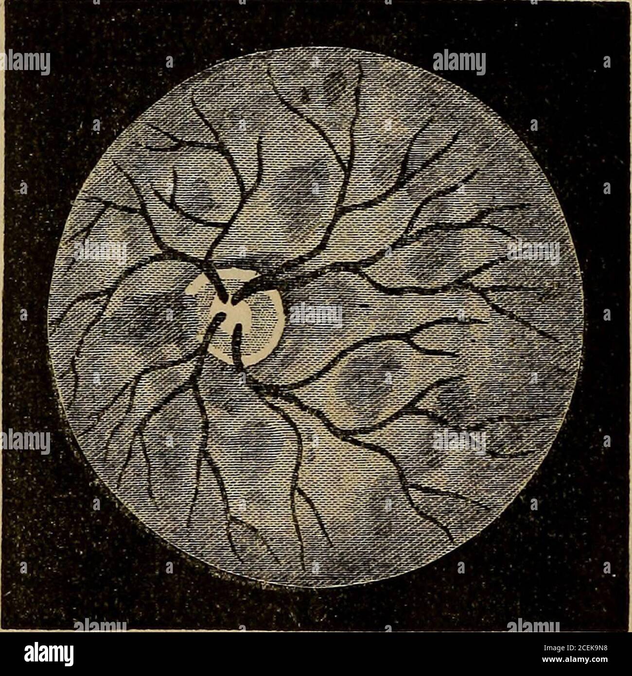 . The ophthalmoscope : its mode of application explained, and its value ...