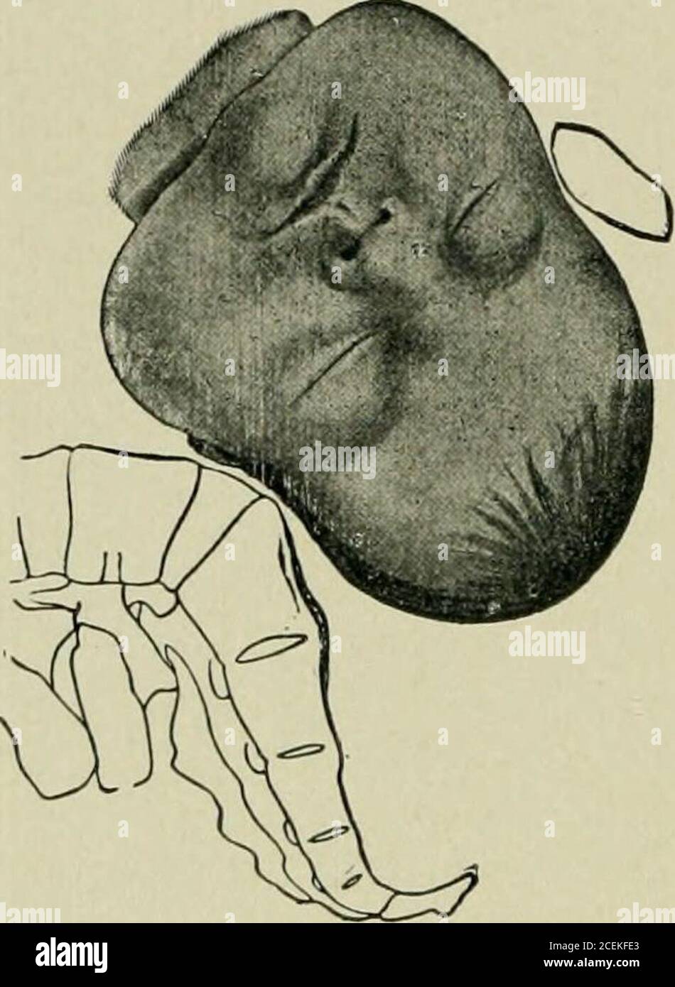 Cervix dilatation hi-res stock photography and images - Alamy
