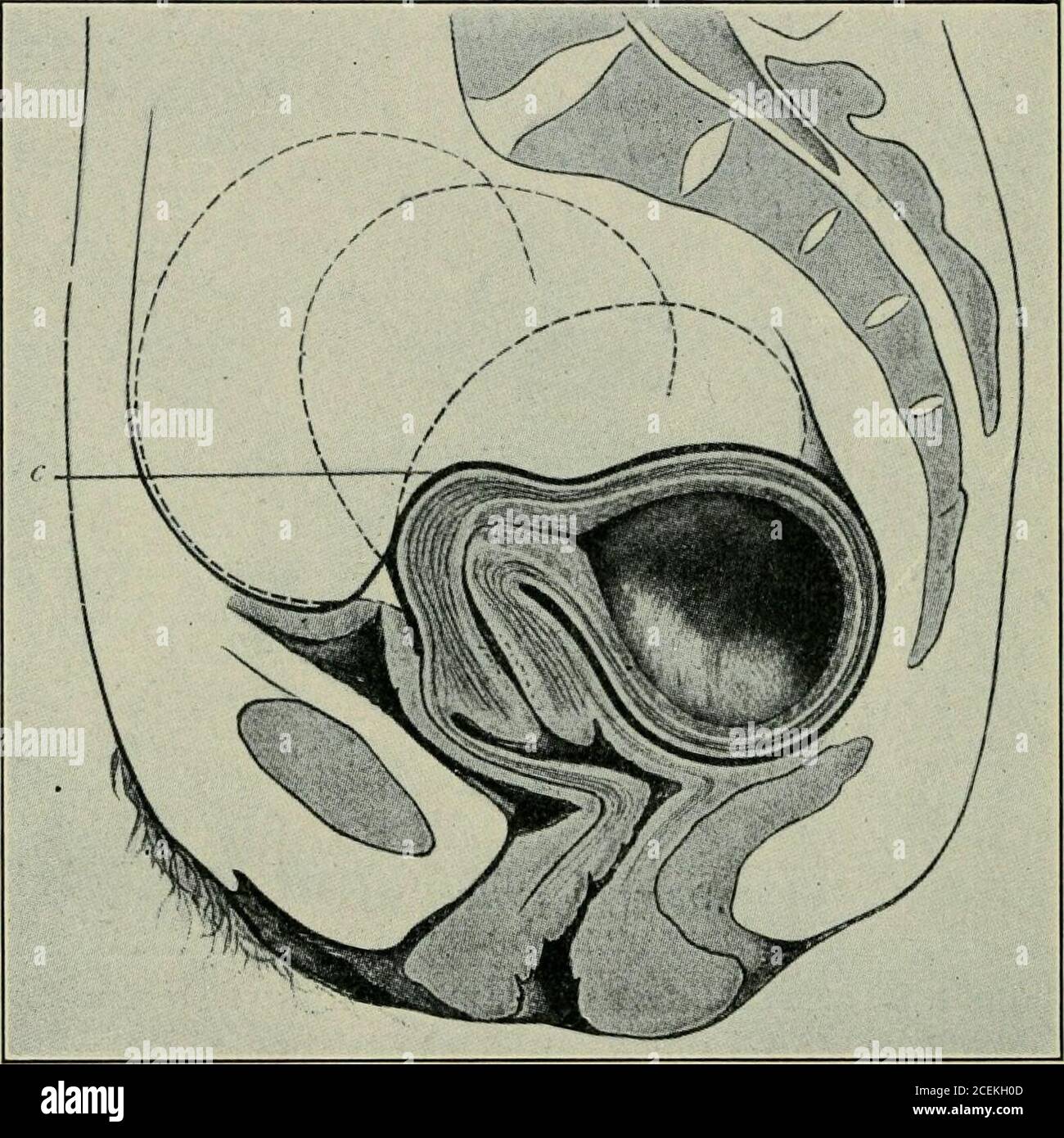Uterus Position At 22 Weeks Gestation