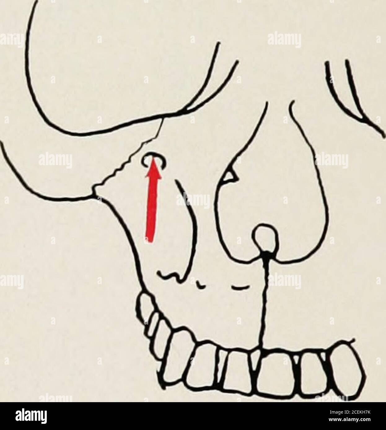 . Oral anaesthesia; local anaesthesia in the oral cavity, technique and ...