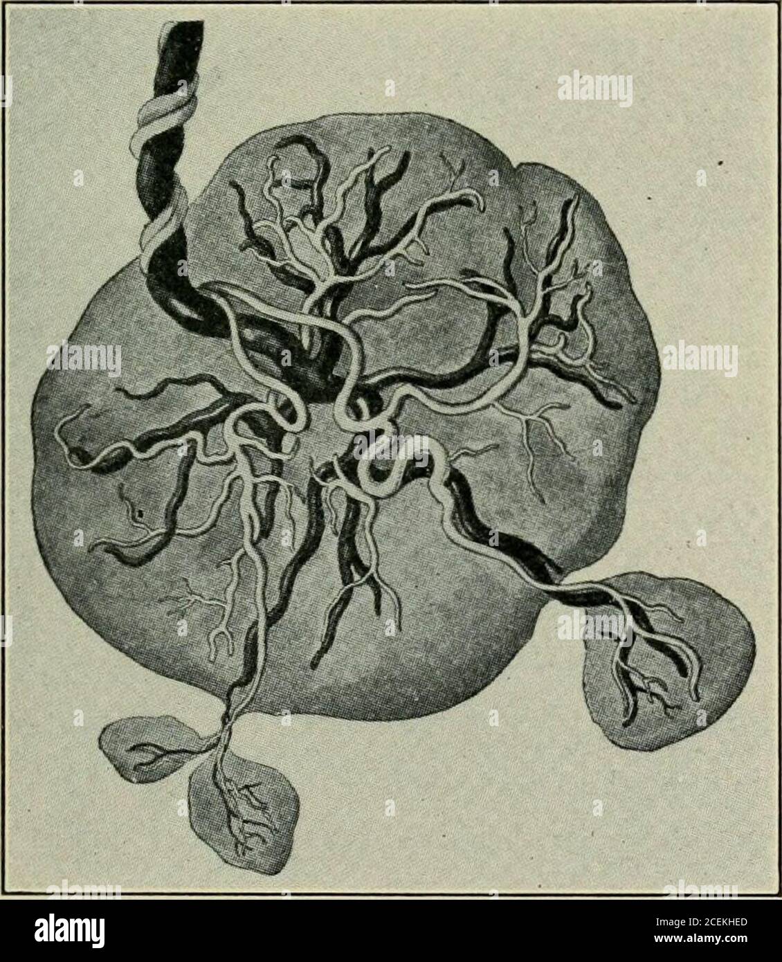 . Obstetrics for nurses. nd placenta the latter may even exceed the ...