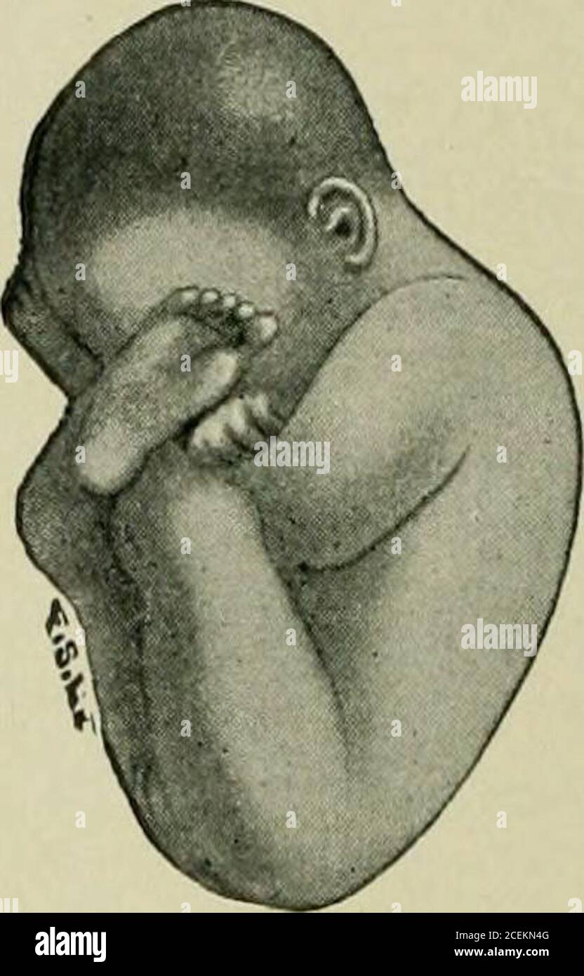 . Obstetrics for nurses. Fig. 60. Fig. 61. Fig. 62. Fig. 60 ...