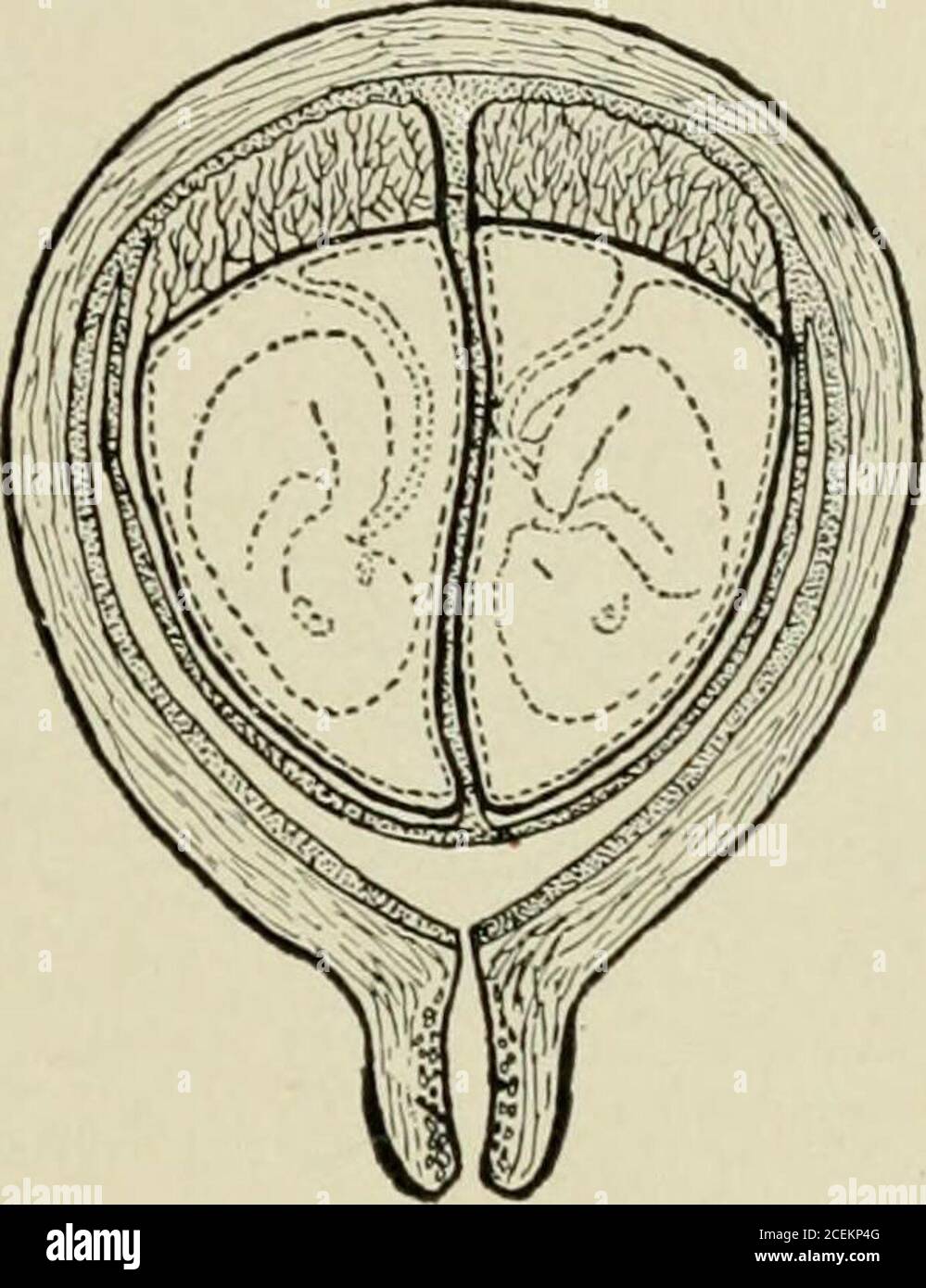 Double placenta hi-res stock photography and images - Alamy