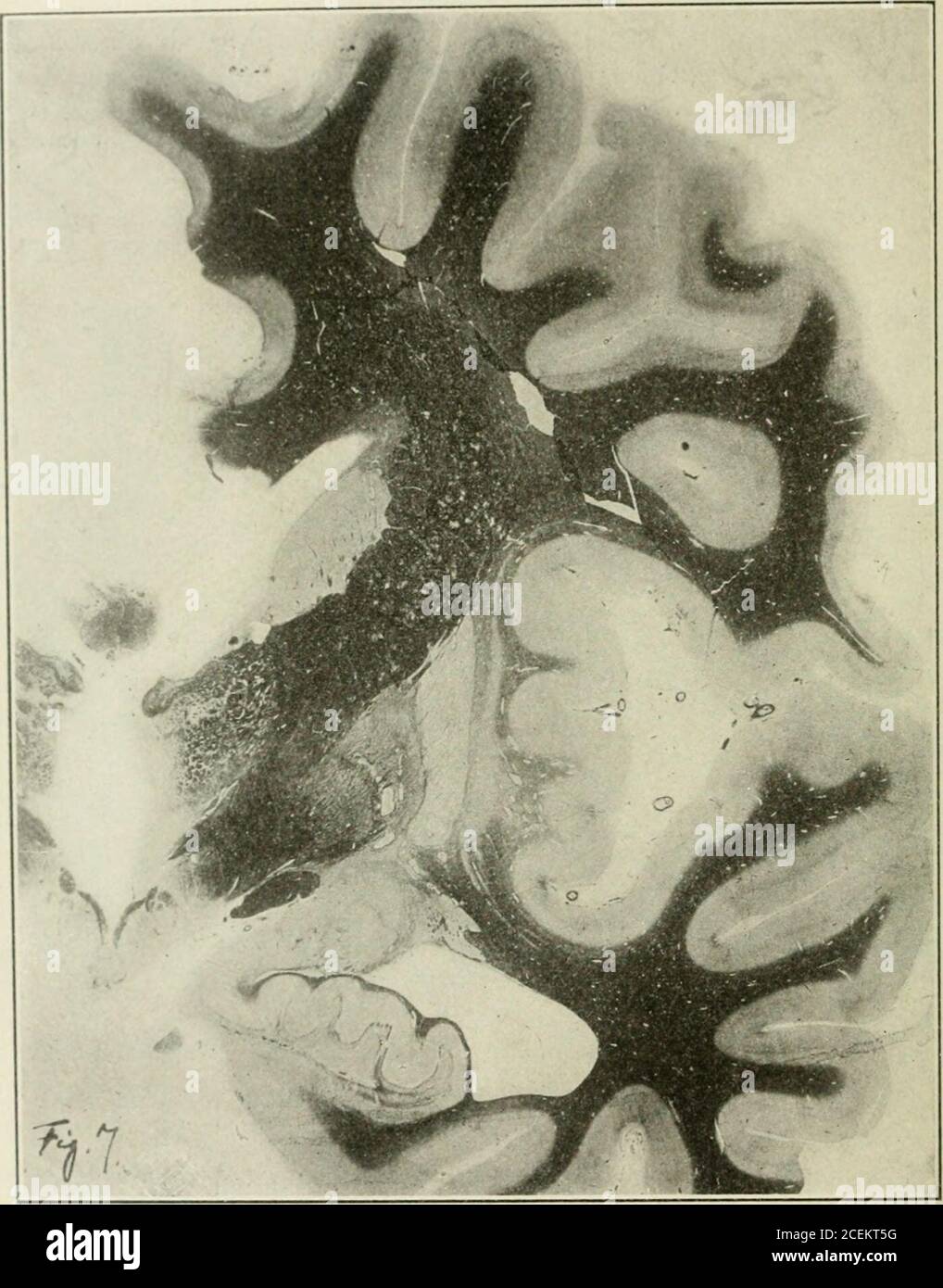 Lenticular process hi-res stock photography and images - Alamy