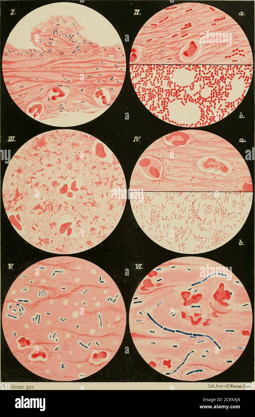 Gram Positive Diplobacilli