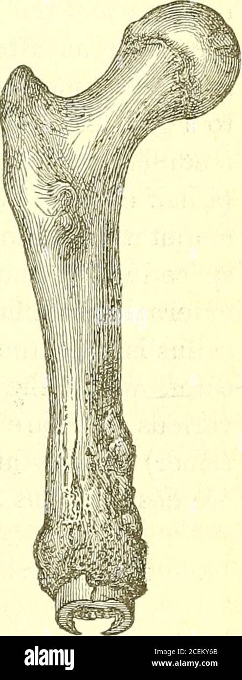 Longitudinal section ofbone hi-res stock photography and images - Alamy