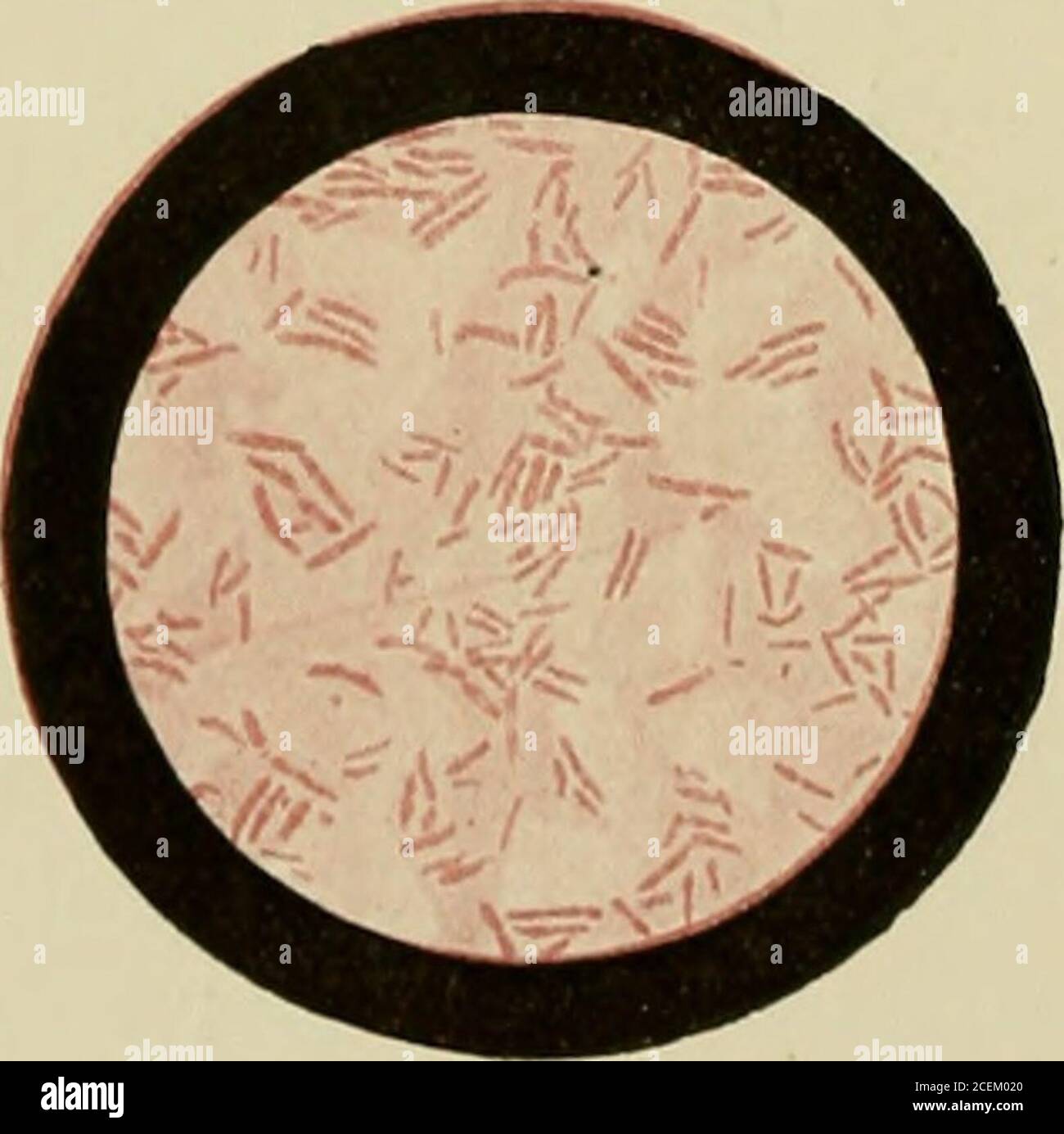 Conjunctival sac hi-res stock photography and images - Alamy