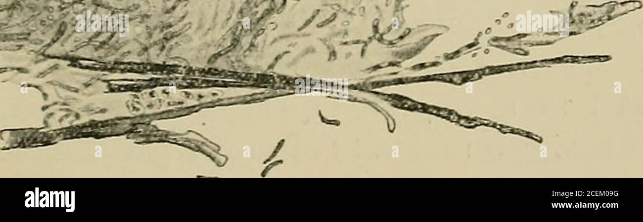 . The bacteriology of the eye. 3 Mr* •/ :J. Fig. 69.—Keratomycosis ...
