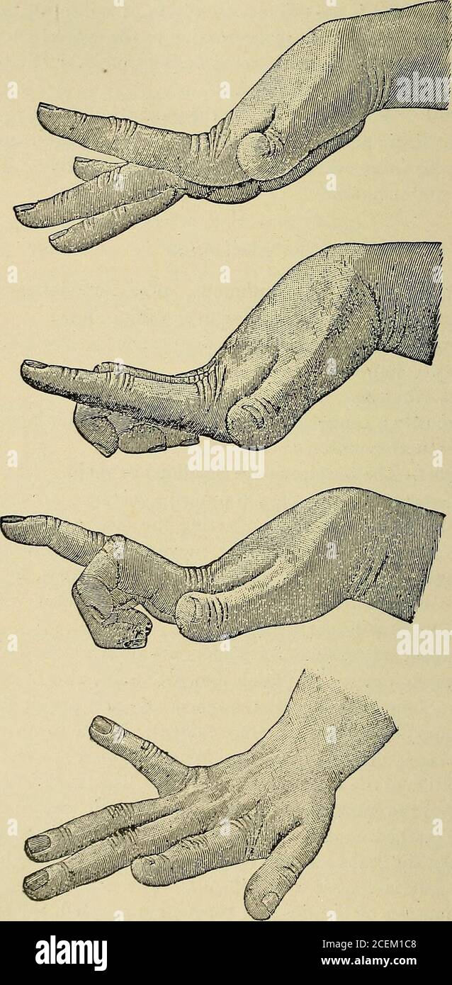 . Diseases of the nervous system : for the general practitioner and ...