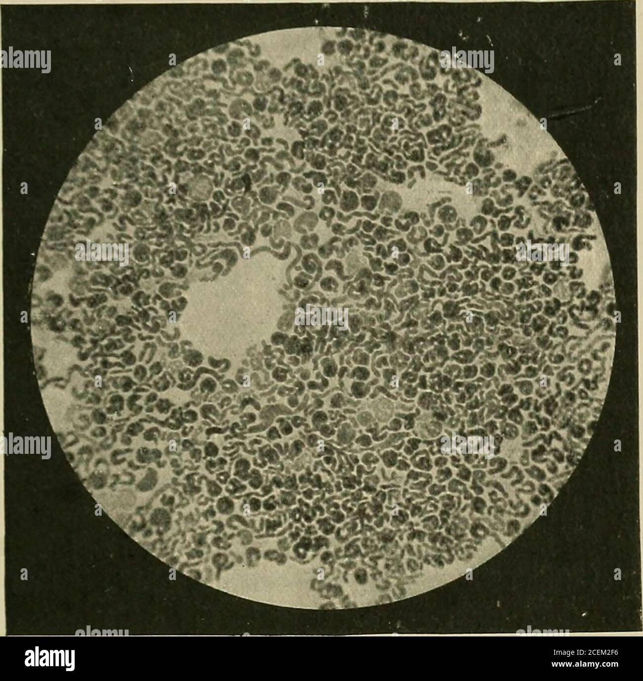 Anaerobic organisms hi-res stock photography and images - Alamy