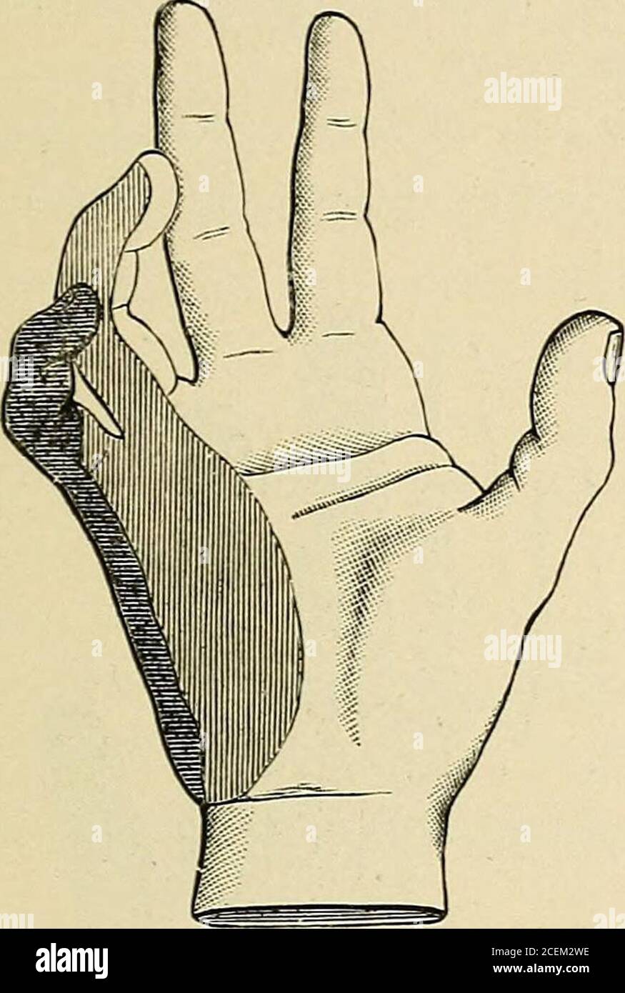 Hand Abduction And Adduction