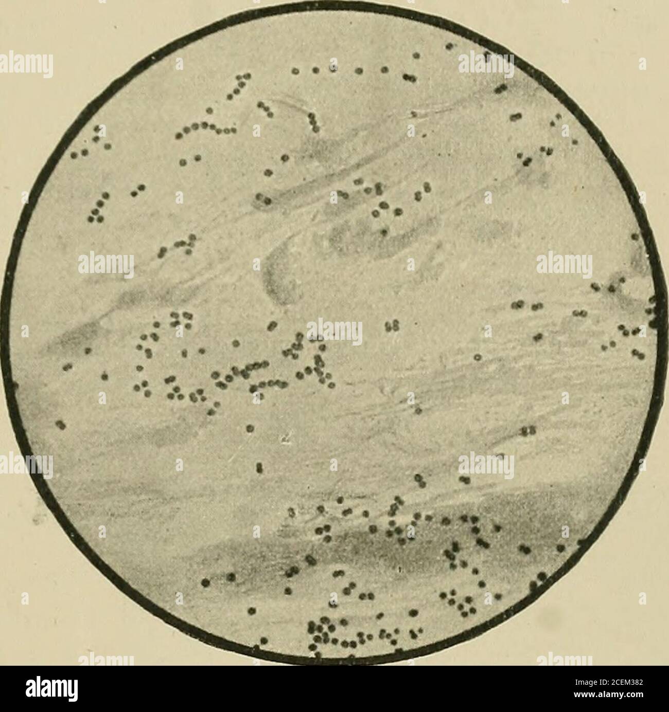 . The bacteriology of the eye. n. In the phagocytesthe cocci often lie ...