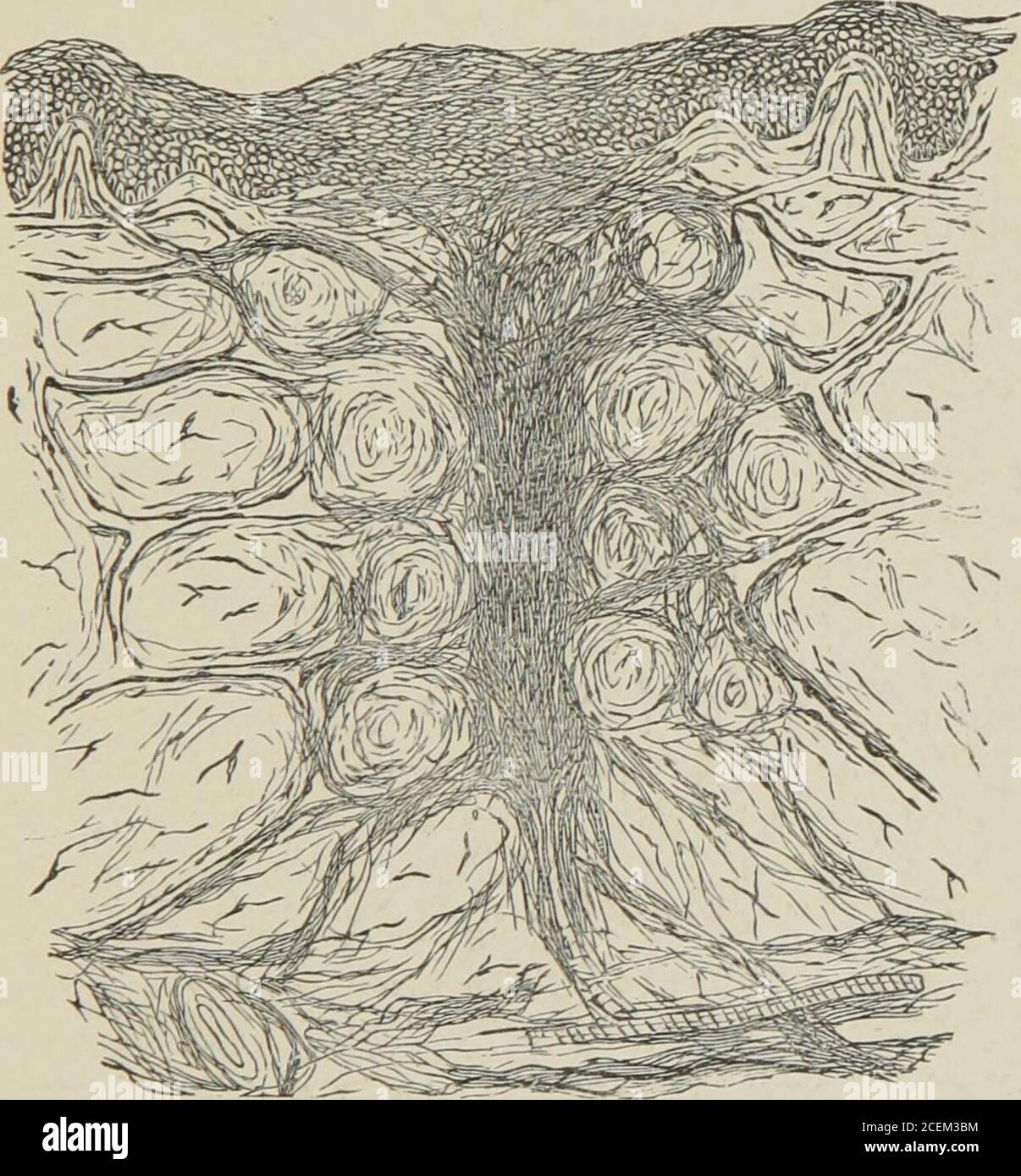 . Surgical and gynæcological nursing. the scar (Fig. 31). Healing by ...