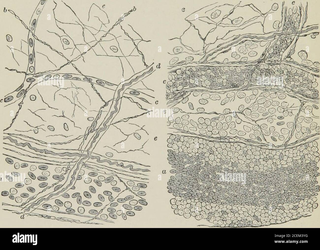 . Surgical and gynæcological nursing. operation. Inflammation is ...