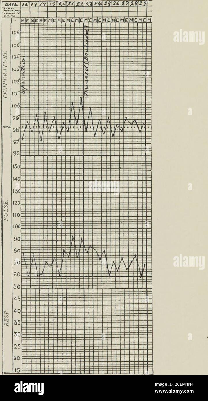 . Surgical and gynæcological nursing. 40 INFECTION. Fig. 13.—Chart ...