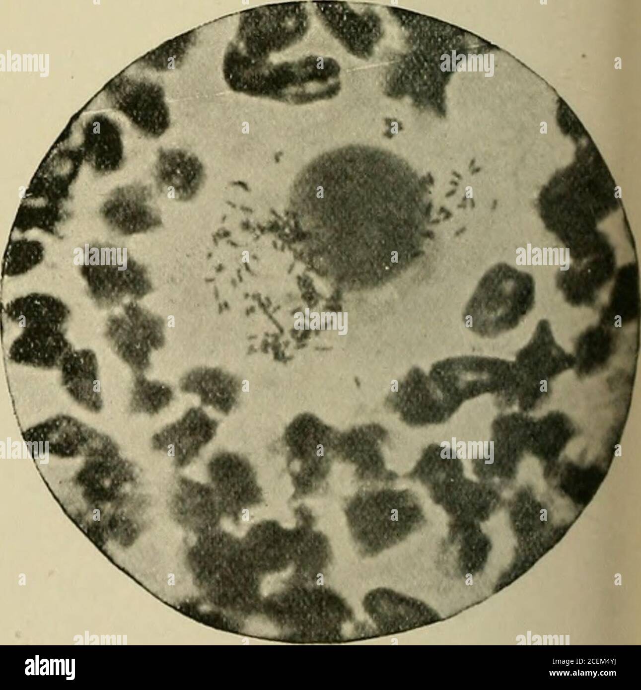 Gram Negative Diplobacilli