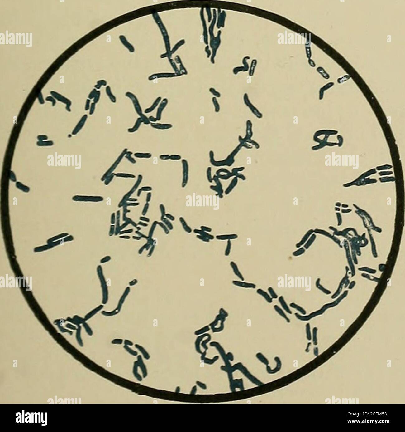 . The bacteriology of the eye. / >
