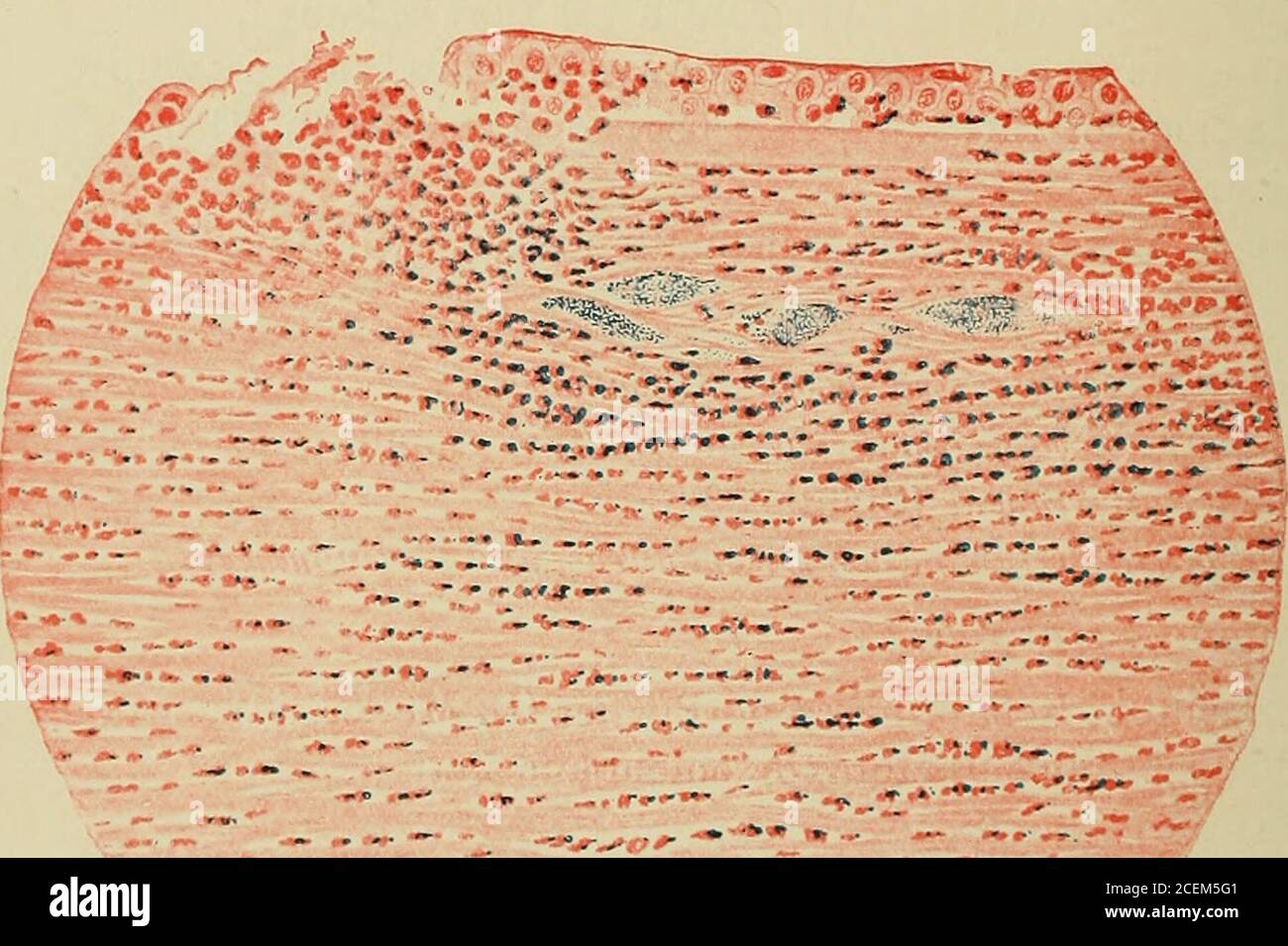 Fibrin Weigert Stain Method