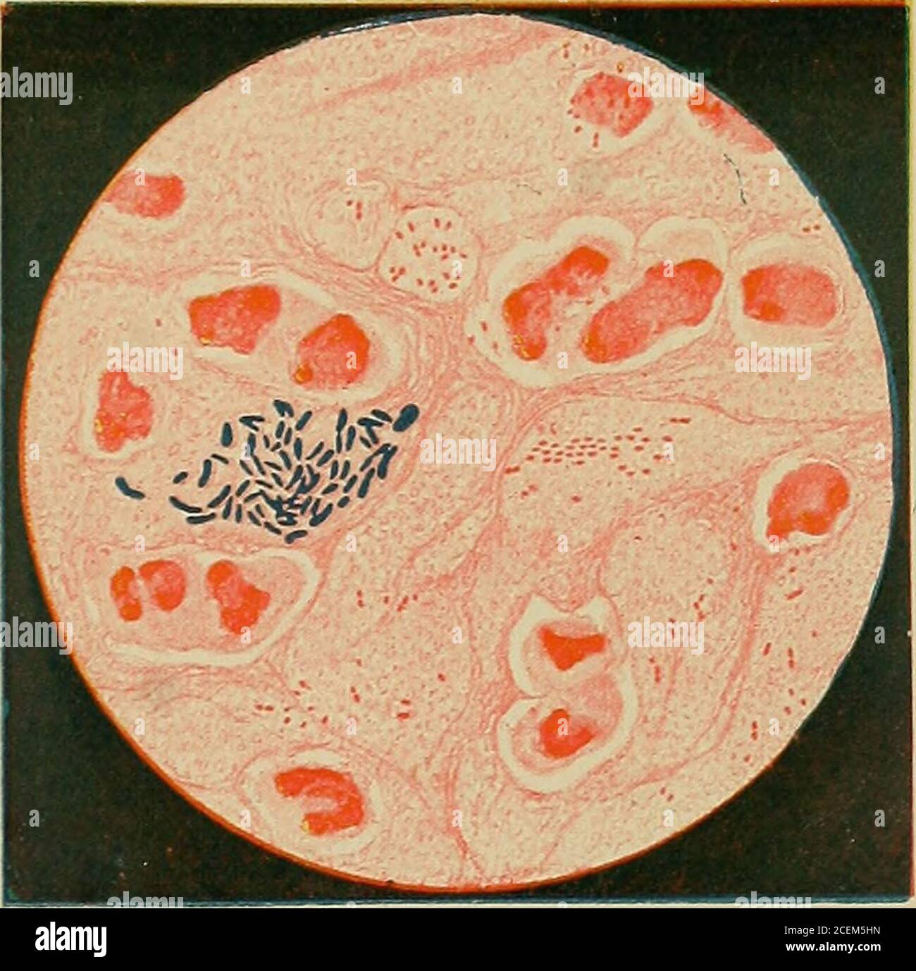 Safranin stain hi-res stock photography and images - Alamy