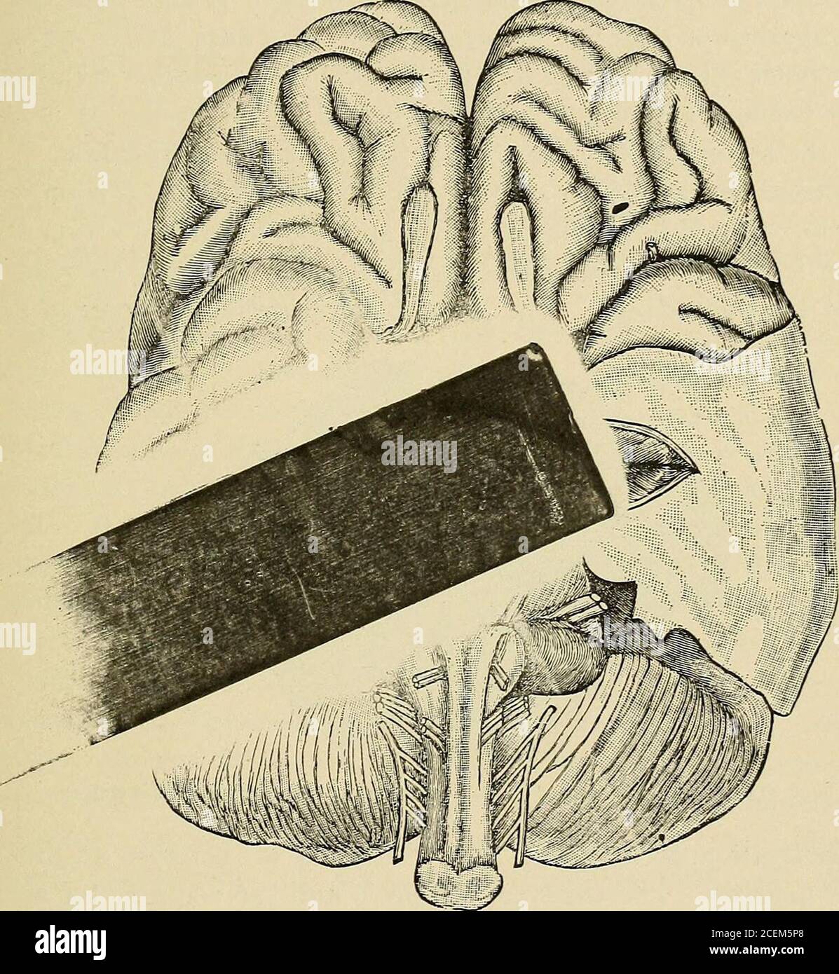 . Diseases of the nervous system : for the general practitioner and ...