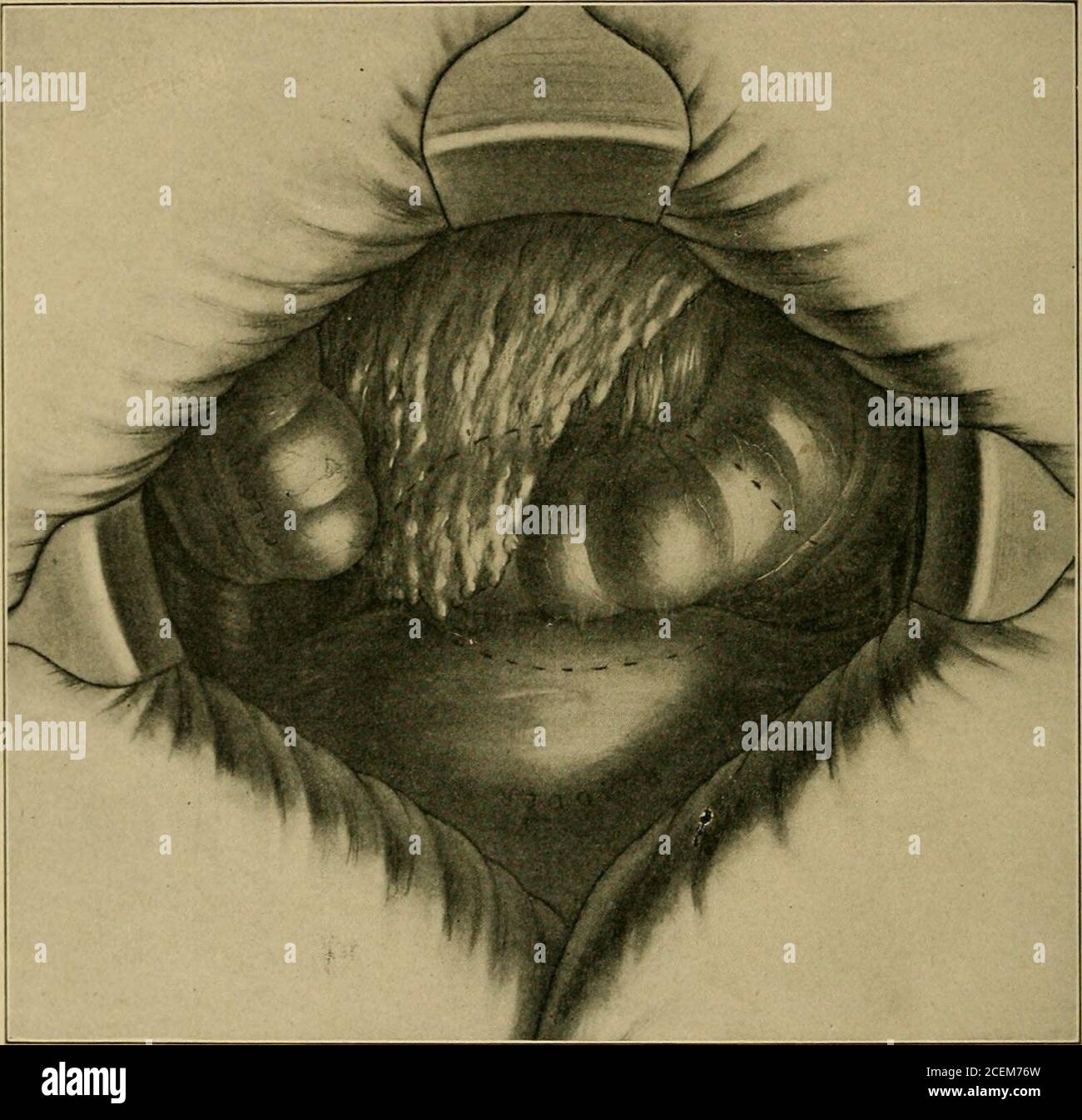 Parietal Peritoneum Frog