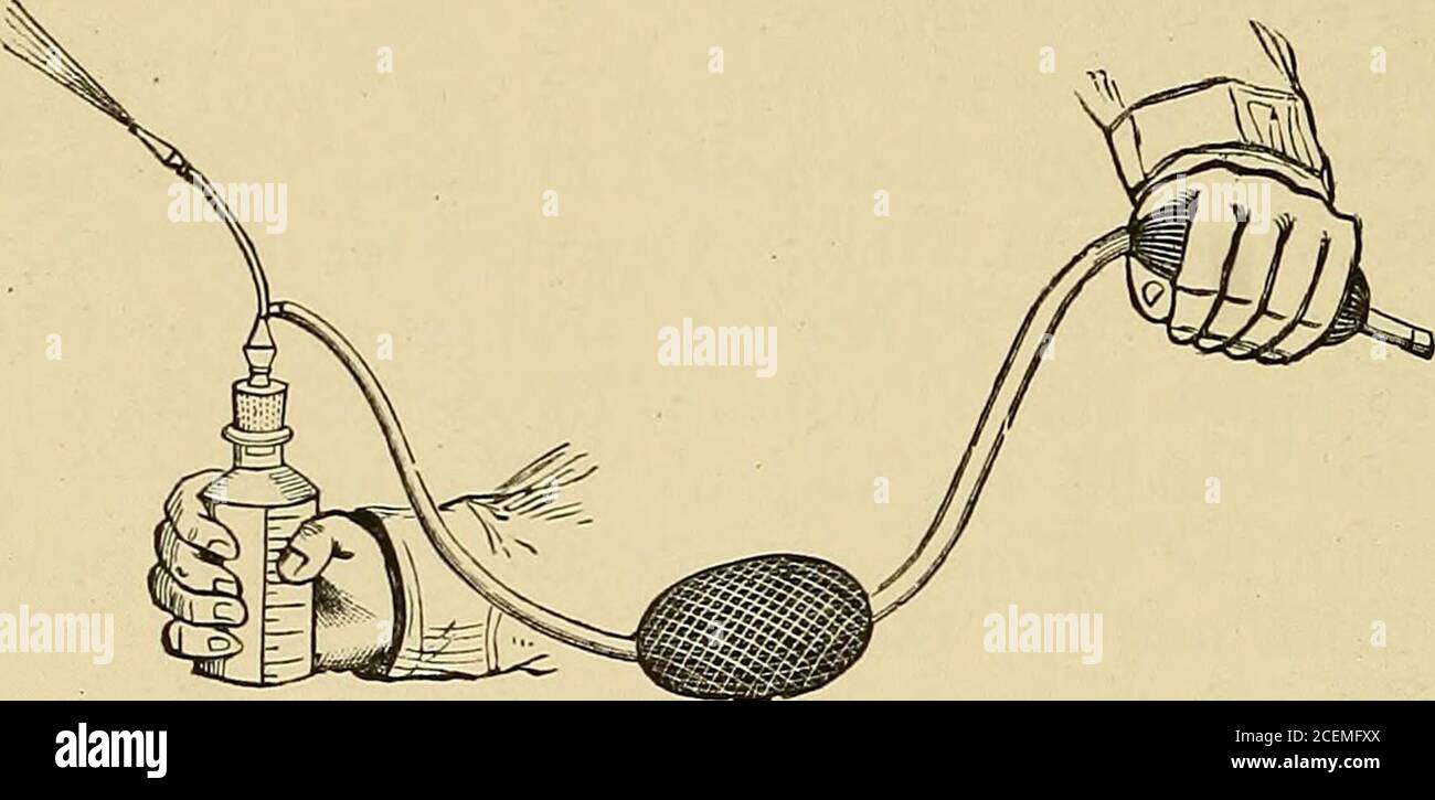 . Anaesthetics : their uses and administration. , under ether spray it ...