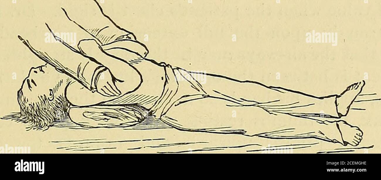 Artificial respiration method hi-res stock photography and images - Alamy