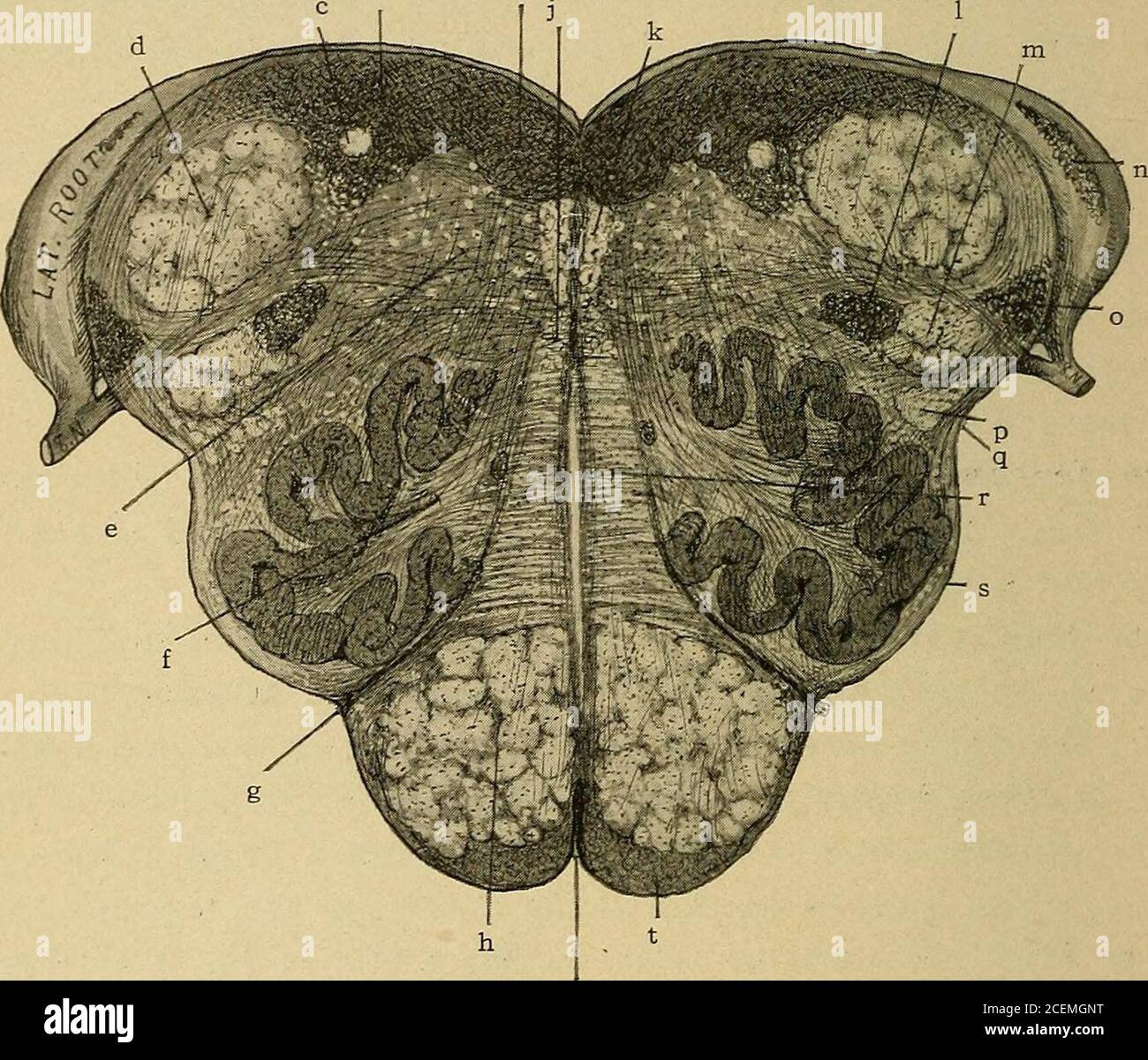 Inferior Cerebellar Peduncle Cross Section