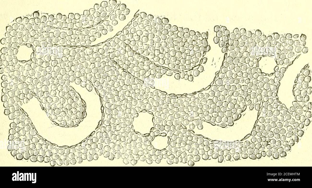 Granulation tissue wound hi-res stock photography and images - Alamy