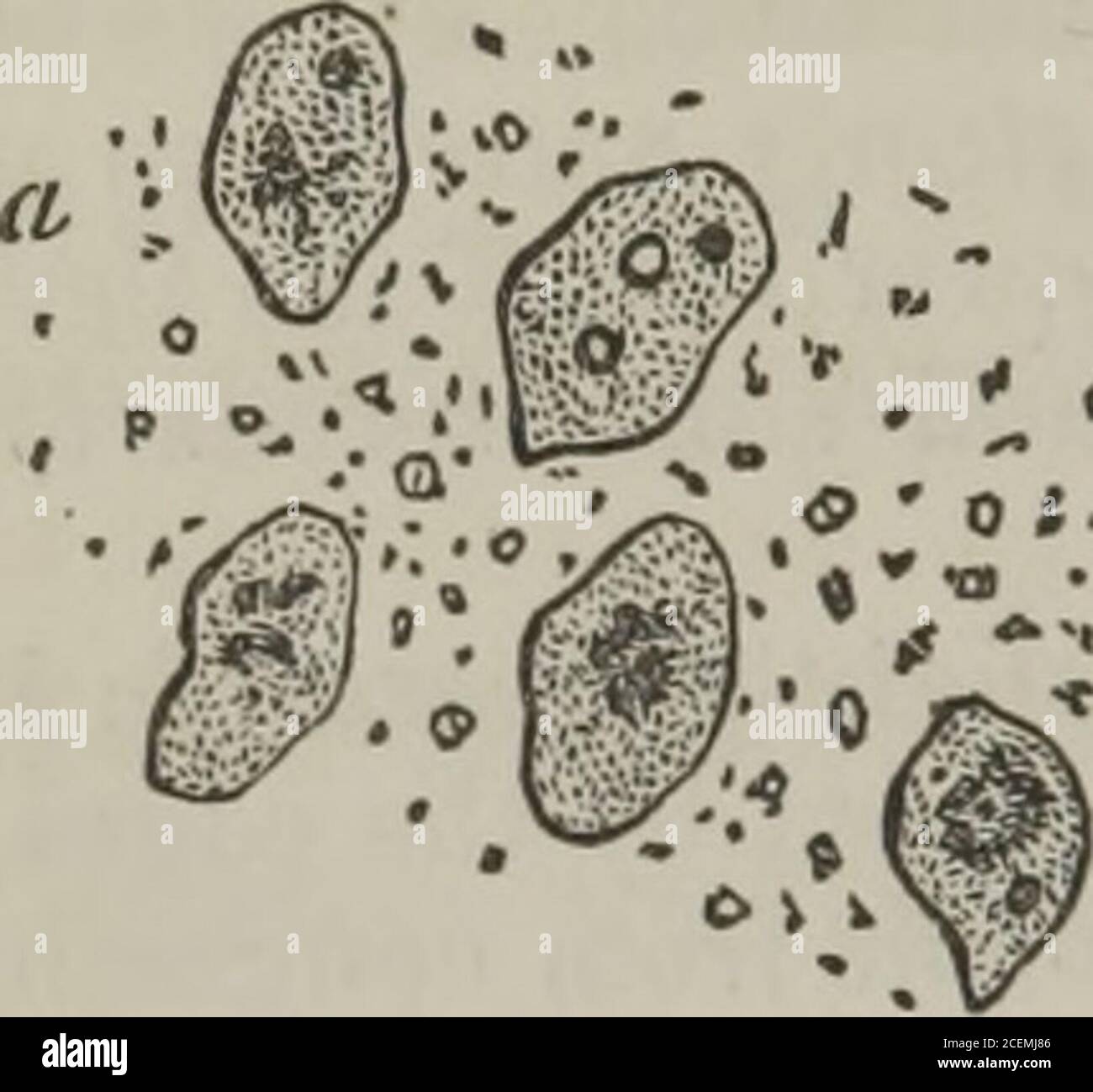 . On diseases of the liver. e duodenal orifice of the common duct. The ...
