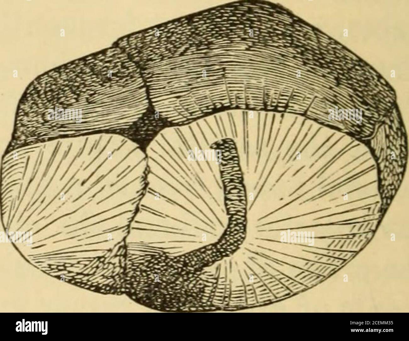 . The science and art of midwifery. us circulation, transudation of ...