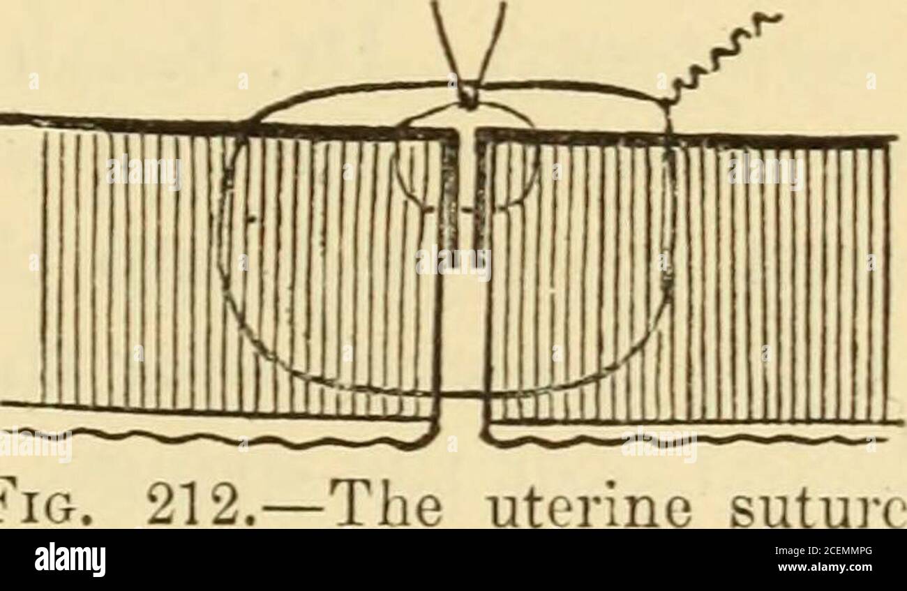Hasbeen termed hi-res stock photography and images - Alamy