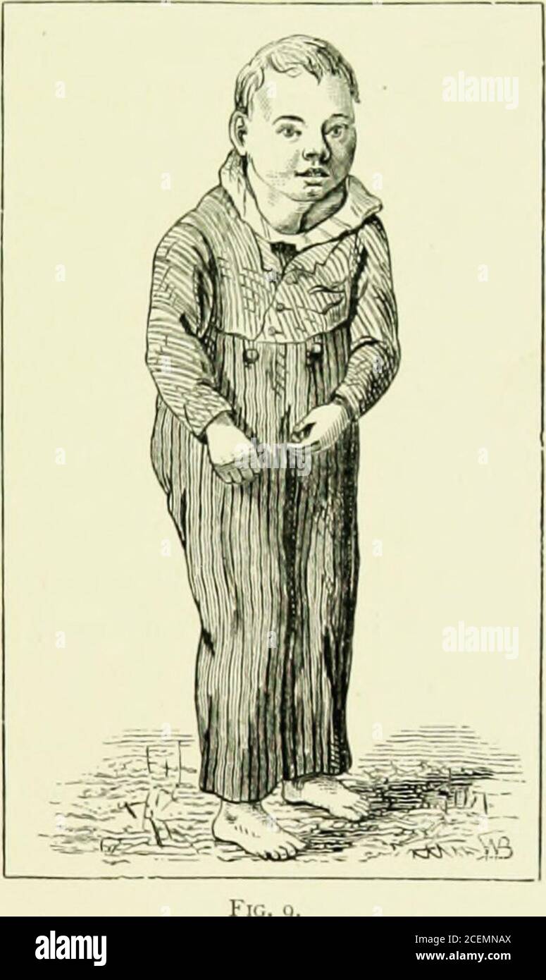 . The mental affections of children : idiocy, imbecility and insanity ...