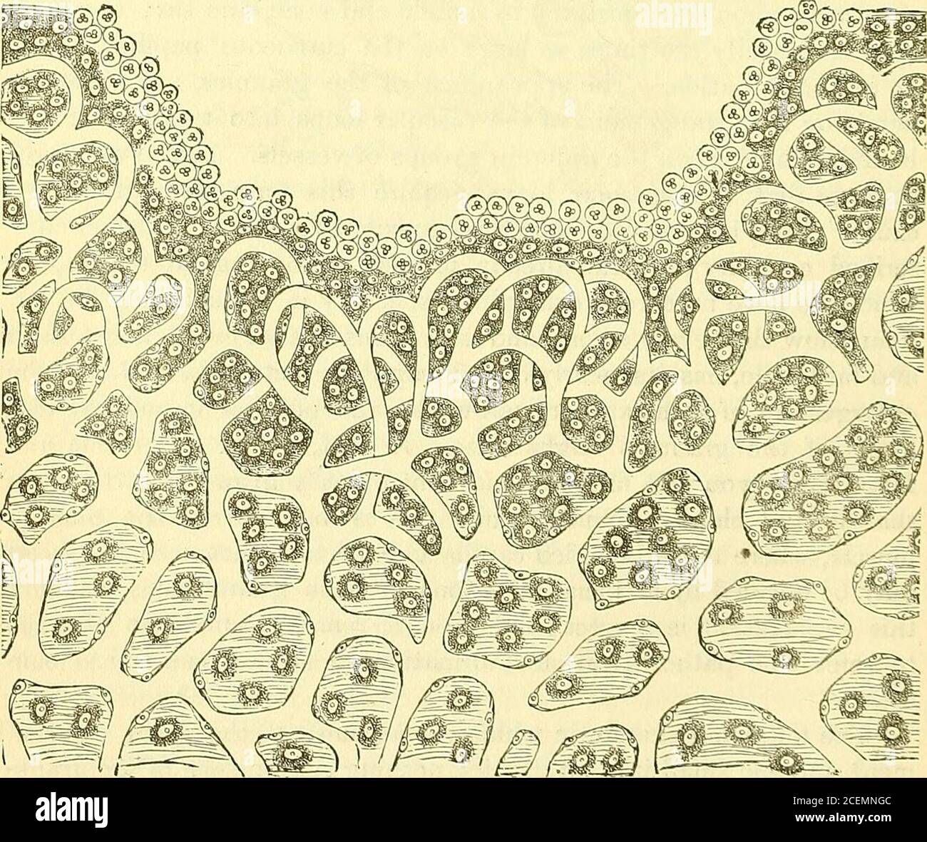 Wound secretion hi-res stock photography and images - Alamy