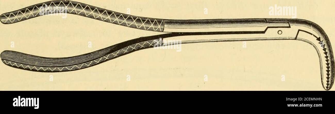 . The science and art of midwifery. rforation introduce a forceps-blade ...